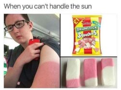 20 Hilarious Sunburns to Make You Feel the Burn - Epic Fails